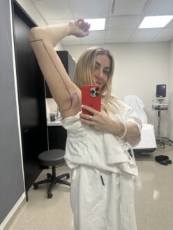 Treating Myself to AirSculpt at Elite Body Sculpture - City Girl Gone Mom